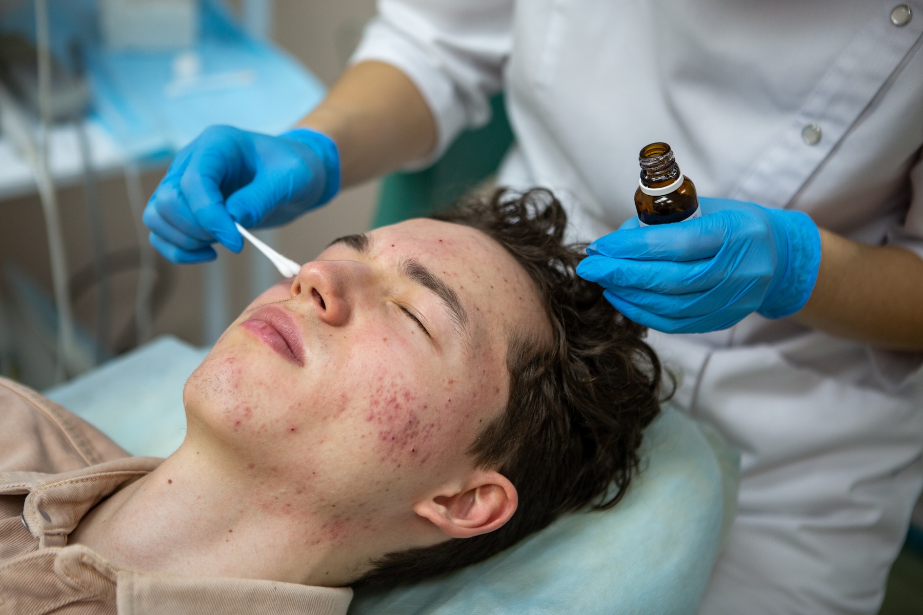 Acne Treatment | Total Skin Dermatology and Aesthetics