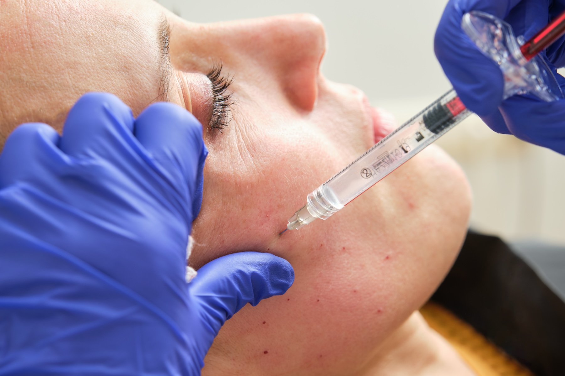 Botox | Total Skin Dermatology and Aesthetics